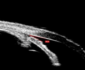 Scanmate Flex - Three Probe Options, One Powerful Platform