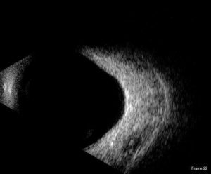 Scanmate B - The Ultra-Portable and Advanced B-scan