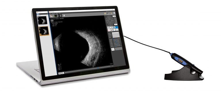 Scanmate B - The Ultra-Portable and Advanced B-scan
