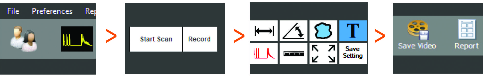 Scanmate Flex - Three Probe Options, One Powerful Platform