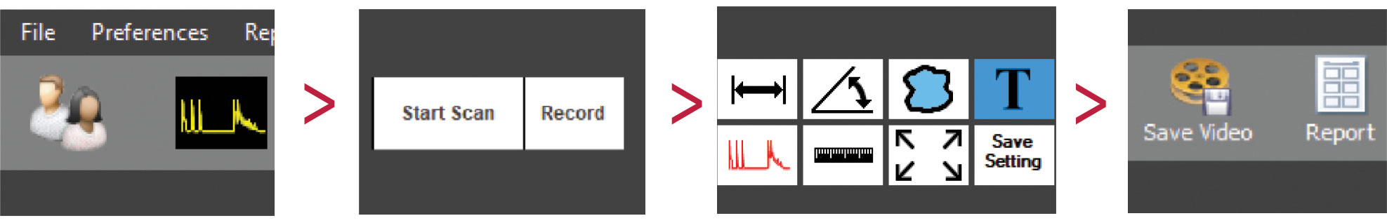 Scanmate B - The Ultra-Portable and Advanced B-scan