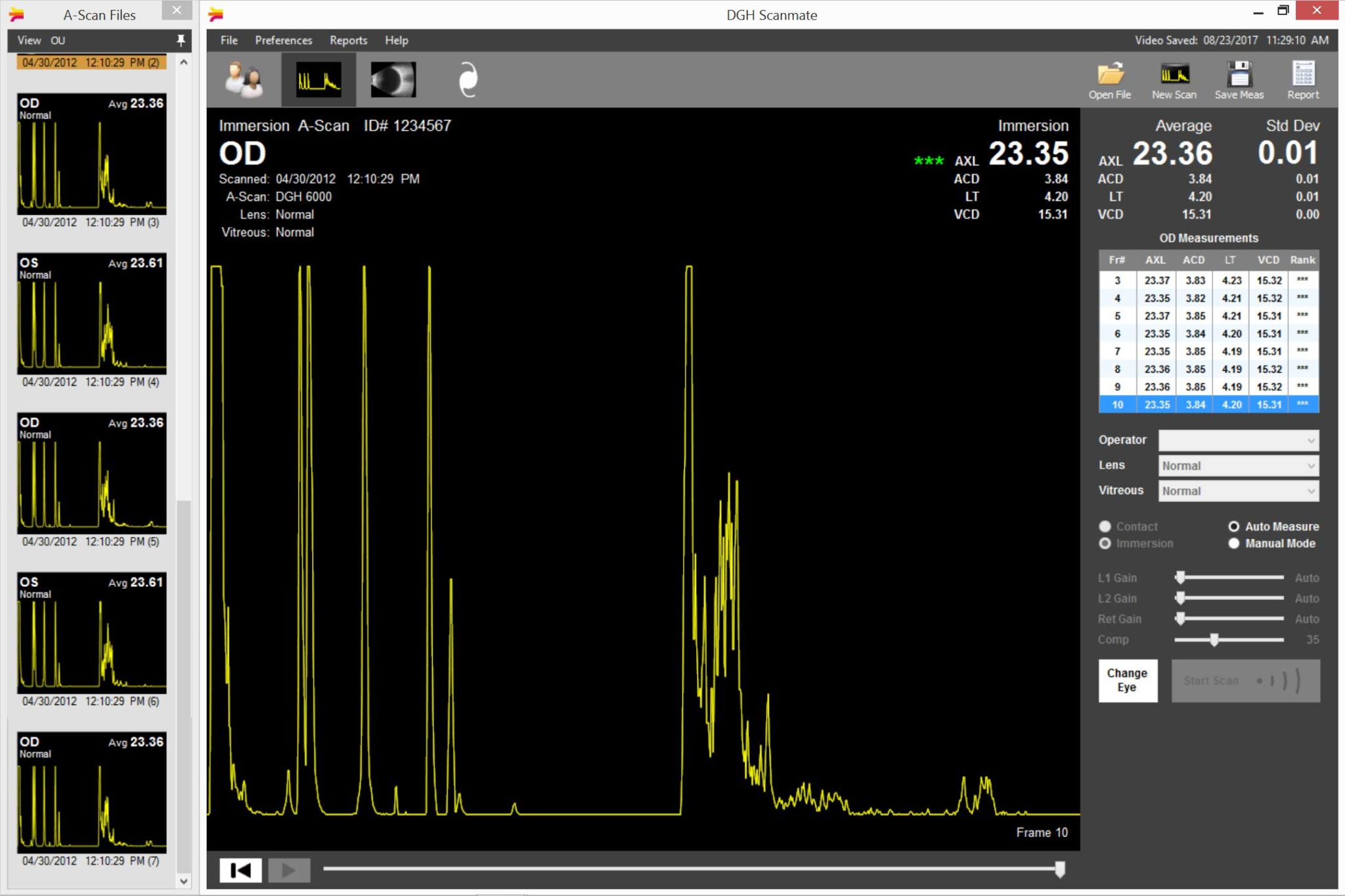 Scanmate A - Innovative, Unique, Ultra-Portable A-Scan